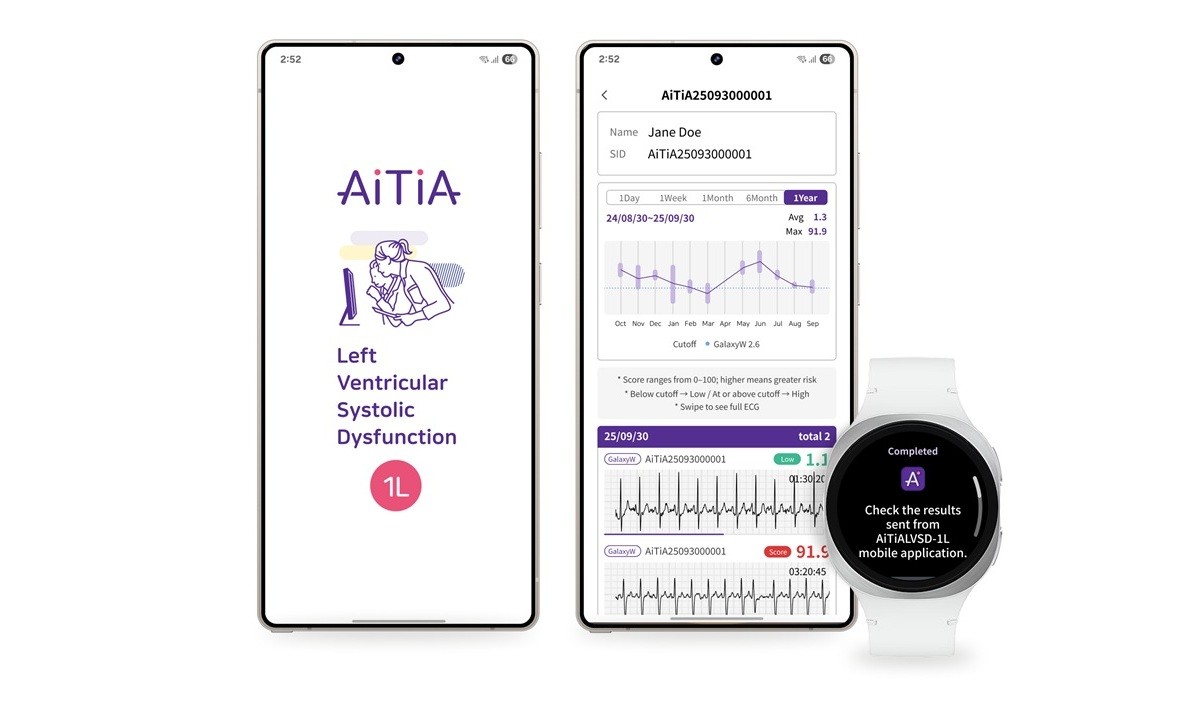 Samsung details upcoming cardiovascular condition detection via ...